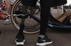 How Much Does a Prosthetic Leg Cost? (2022)