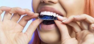 How Much Does a Retainer Cost? (2022)